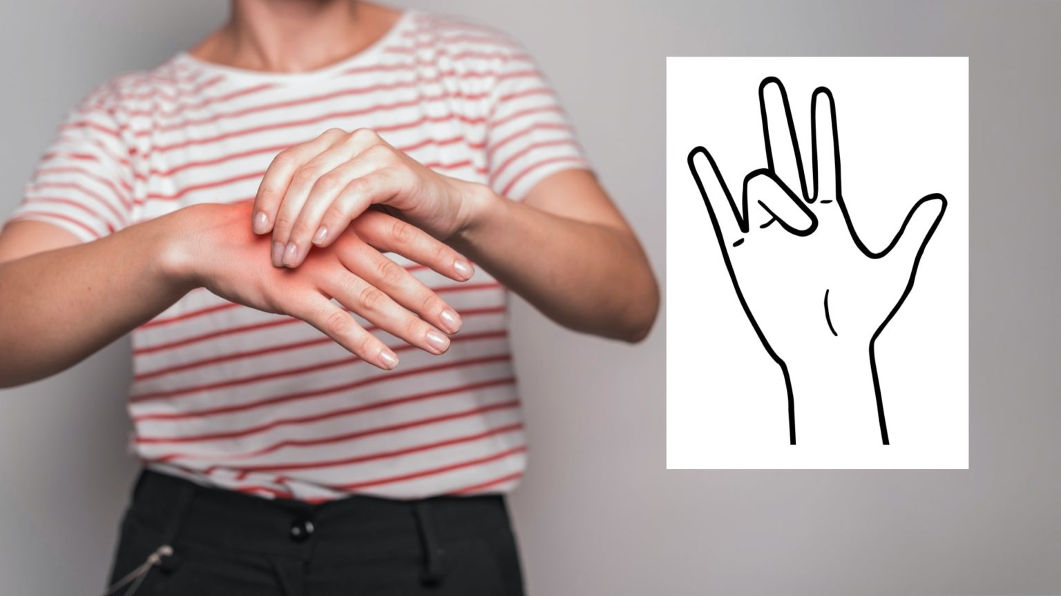 Trigger Finger: TOP 10 Questions - hariQ acupuncture & herbs