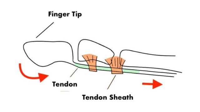 Easy 8 Steps Massages for Trigger Finger - hariQ acupuncture