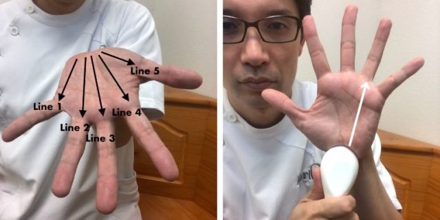 How to Use One Spoon for Trigger Finger - heriQ acupuncture